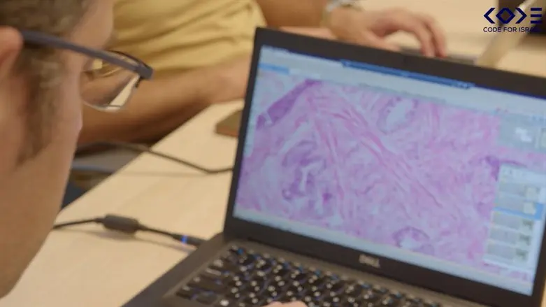 Israeli hi-tech employees volunteer - and help cancer patients | Israel ...